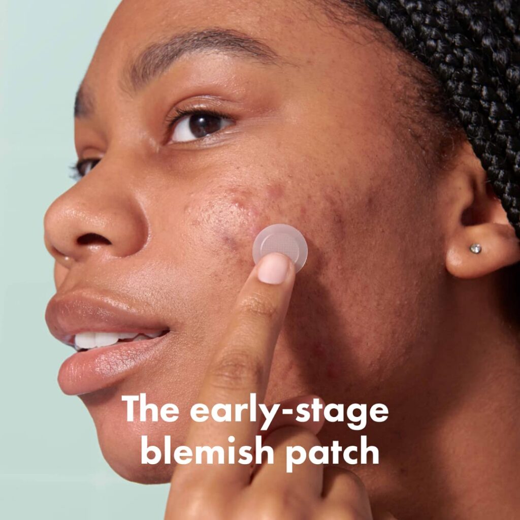 Mighty Patch Micropoint Review - Vibrant Beauty Health